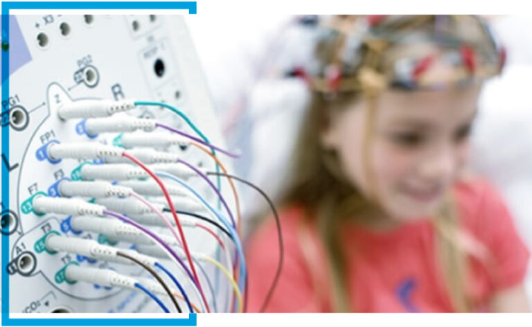 Electroencefalograma Precio - Dificultades y Procedimiento